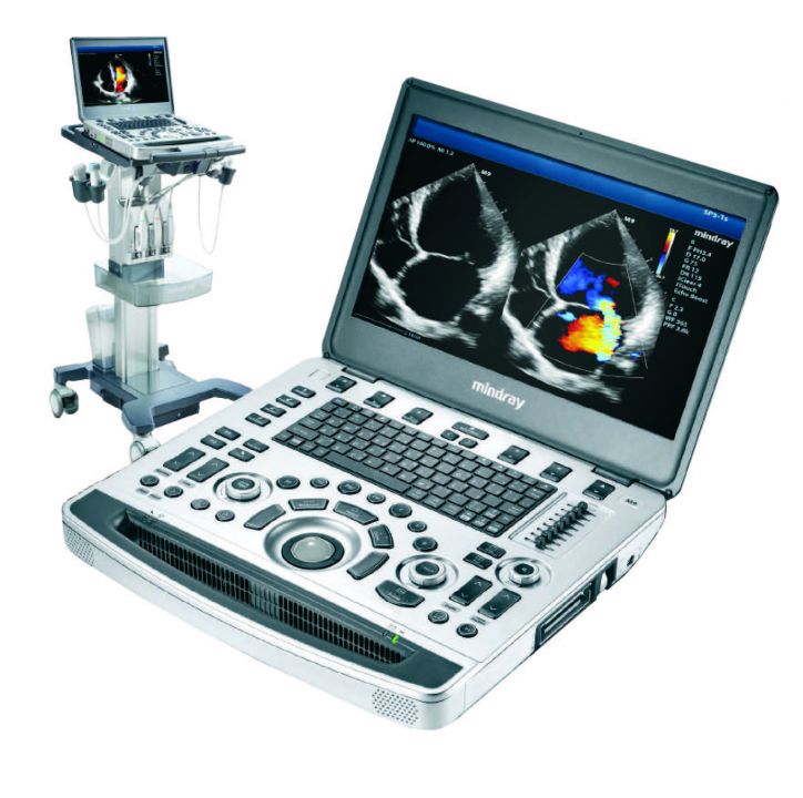 Screenings – CardiOptics